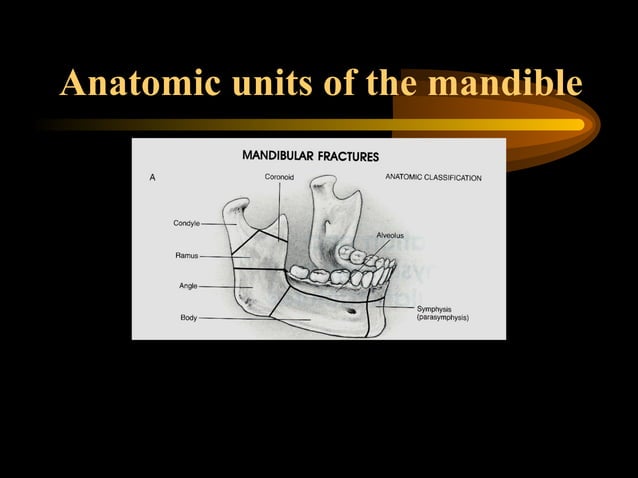 Mandible fracture signs and symptoms ppt | PPT