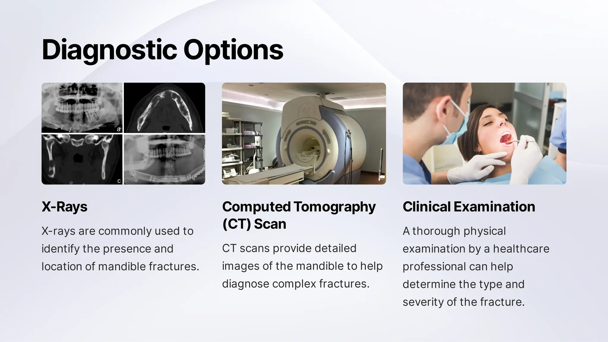 Mandible-Lower-Jaw-Fracture (1).pdf | Death, Injury, or Military ...