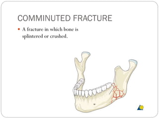 Comminuted Fracture Of Mandible
