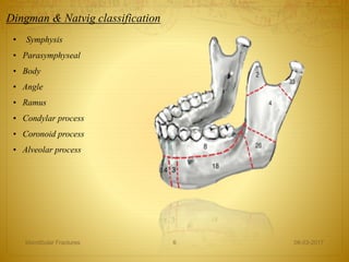 Mandible # brief | PPTX