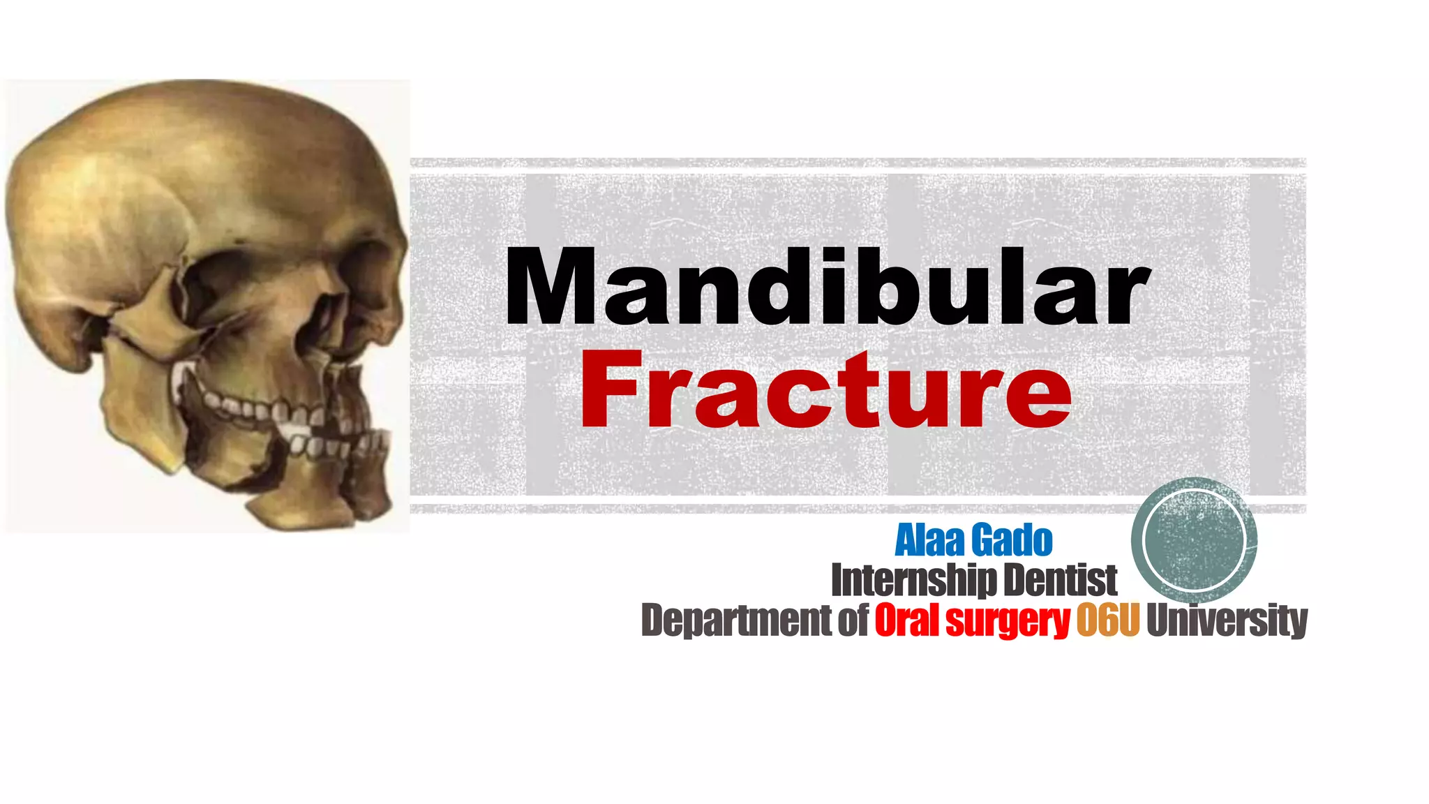 Mandibular Fractures | PPTX