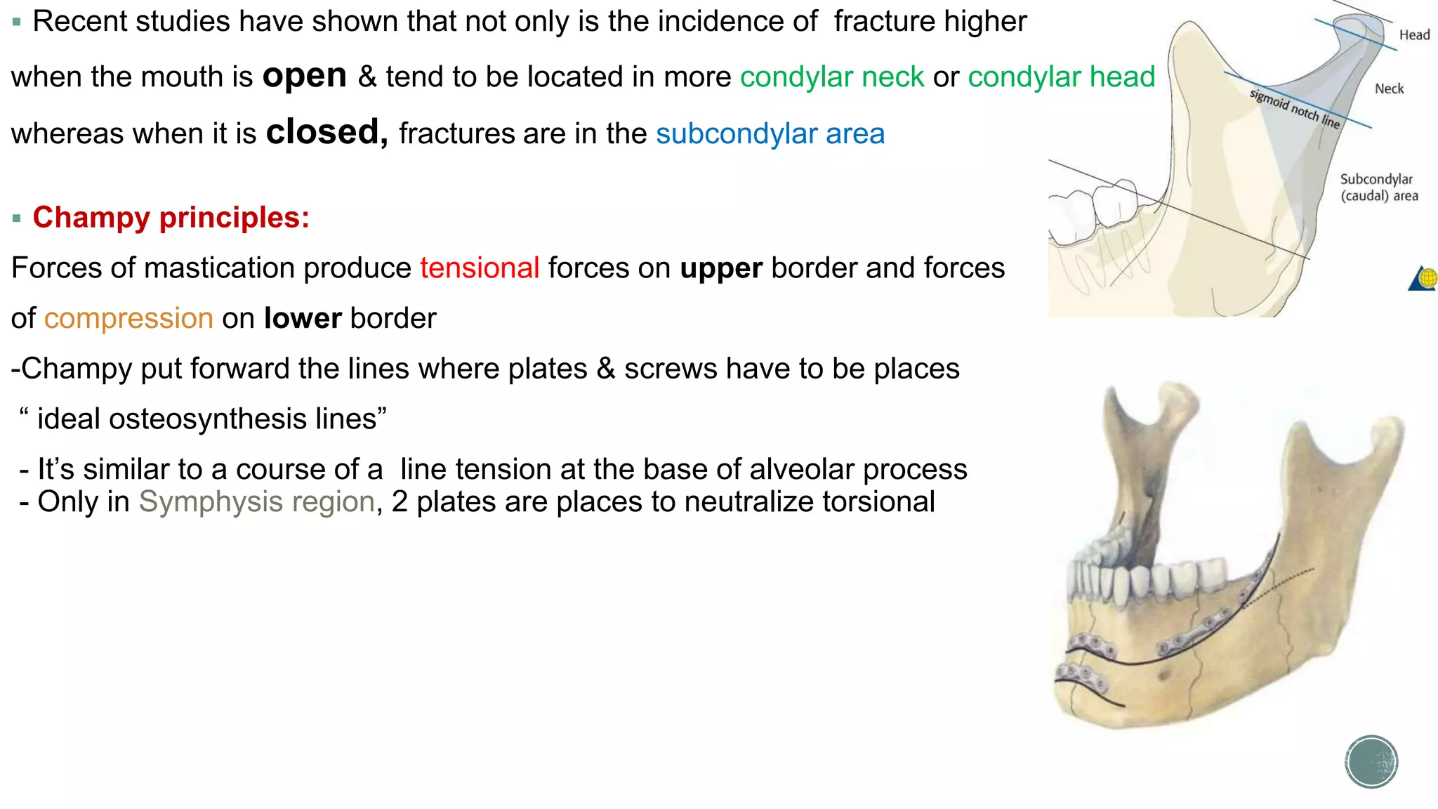 Mandibular Fractures | PPTX