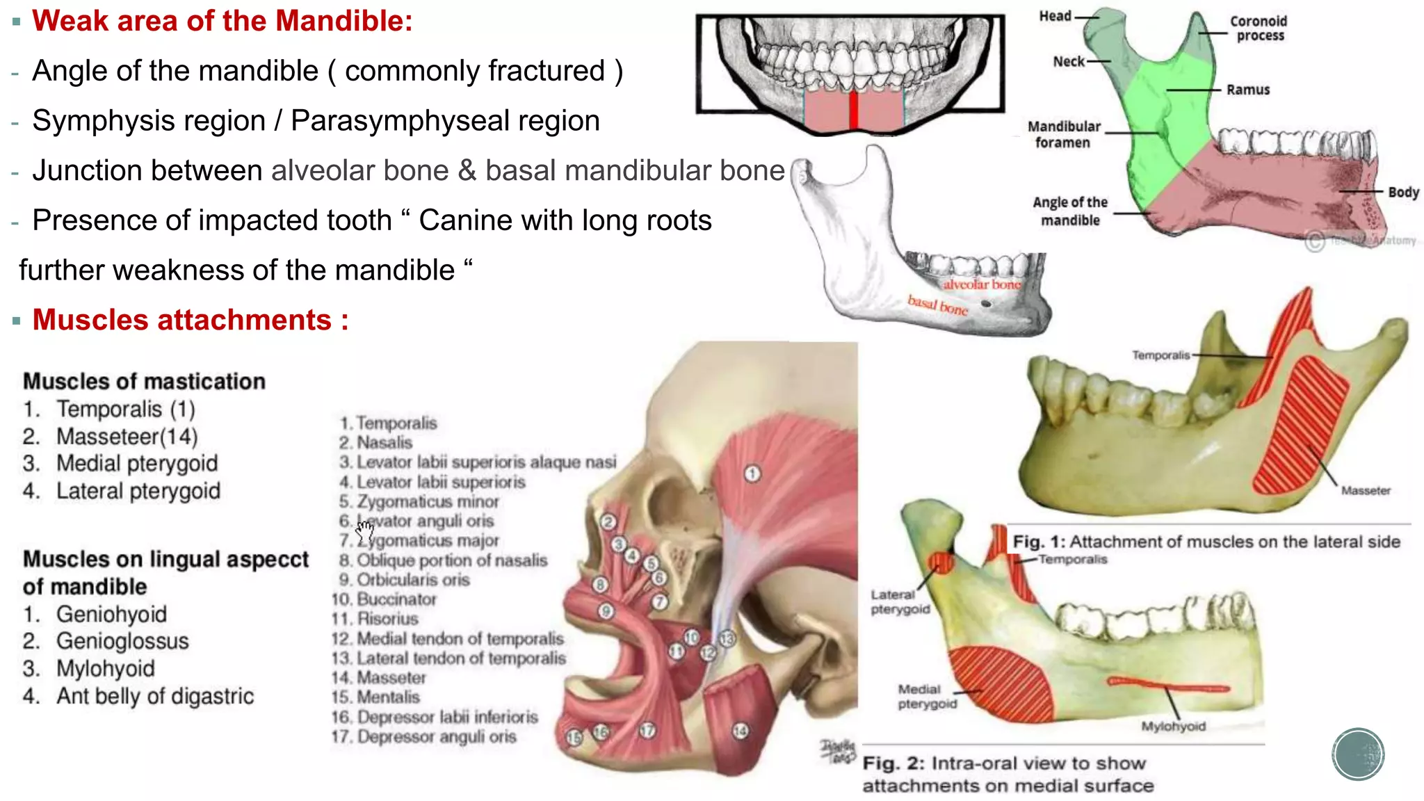 Mandibular Fractures | PPTX