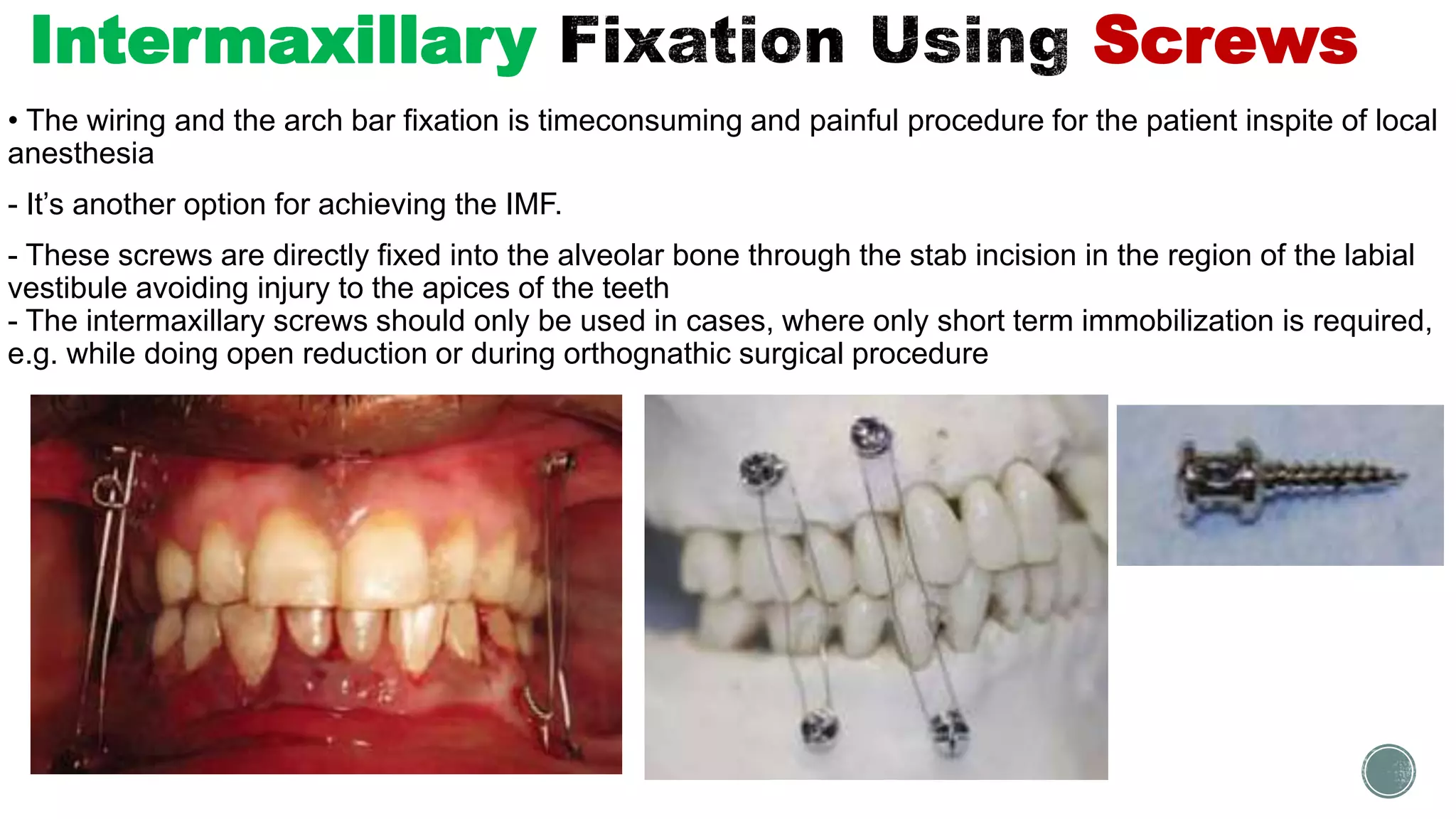 Mandibular Fractures | PPTX