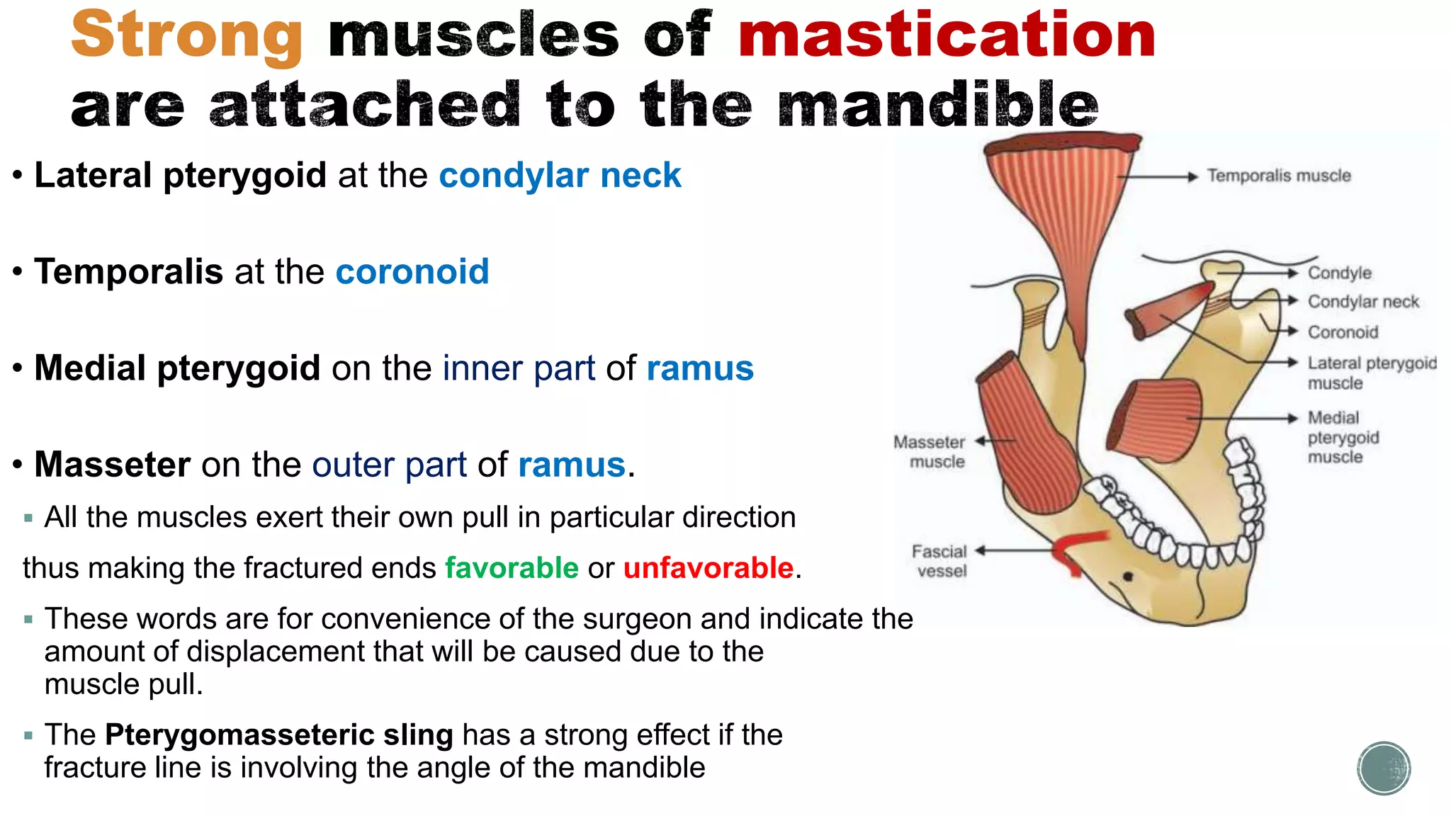 Mandibular Fractures | PPTX