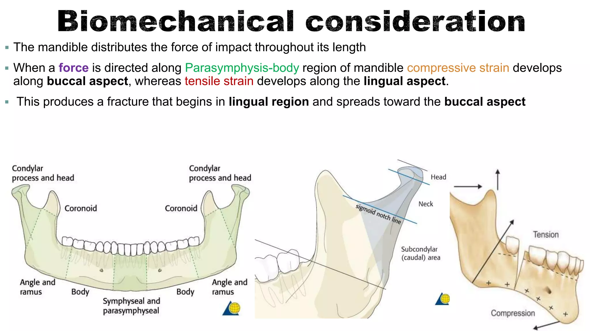 Mandibular Fractures | PPTX