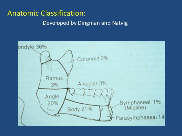 Mandible fracture symposium march-13