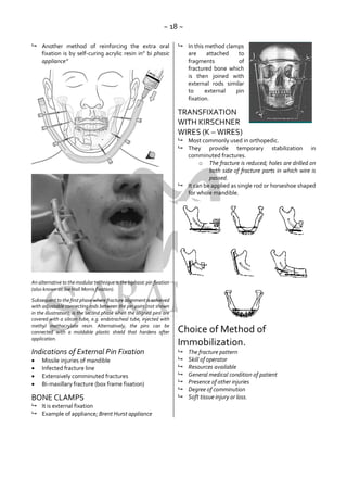 Mandible Fracture | PDF