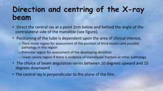 Mandible lateral oblique | PPTX