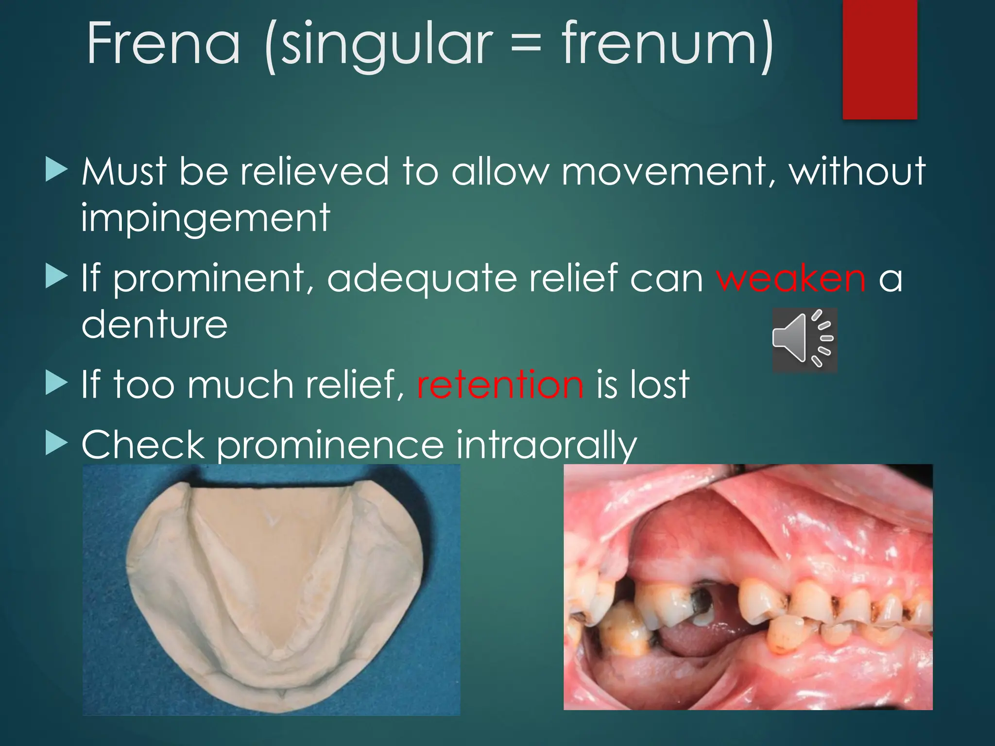 Mandible & Mandibular Denture anatomy1.pptx