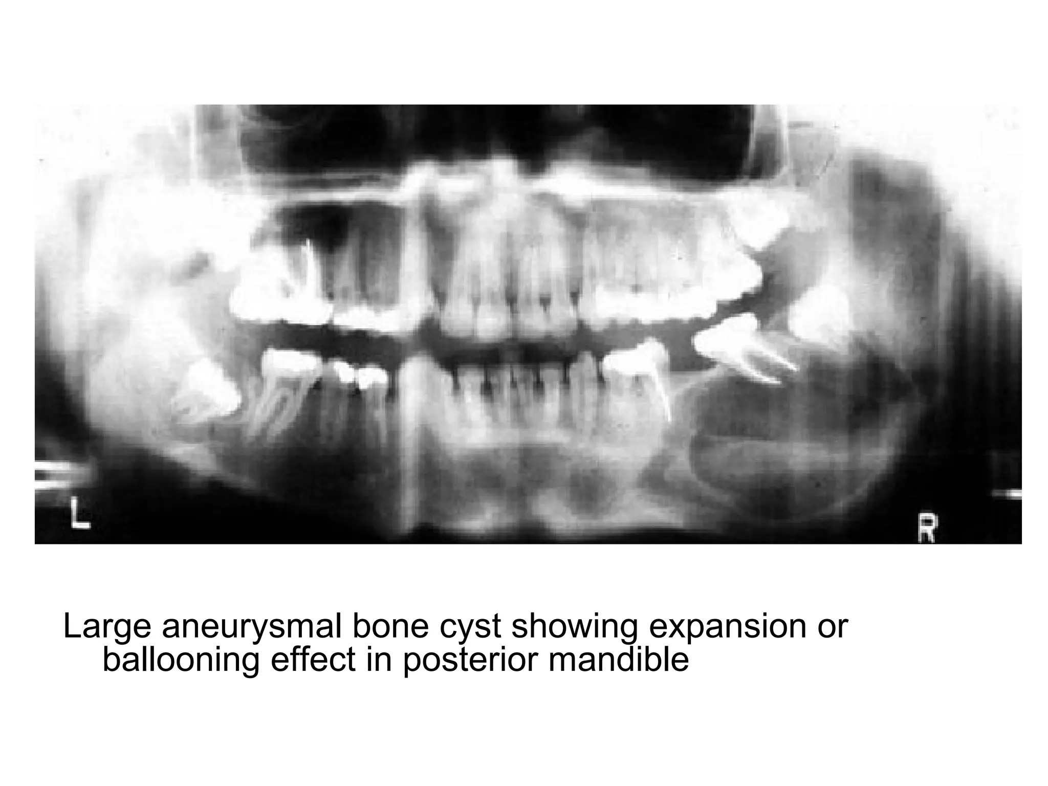 Diagnostic Imaging of Mandible & Maxilla | PPT