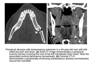 Diagnostic Imaging of Mandible & Maxilla | PPT