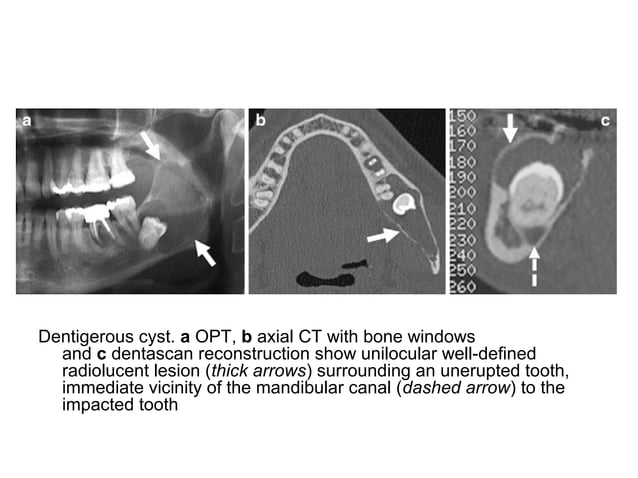 Diagnostic Imaging of Mandible & Maxilla | PPT | Dental Health ...