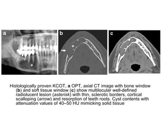 Diagnostic Imaging of Mandible & Maxilla | PPT