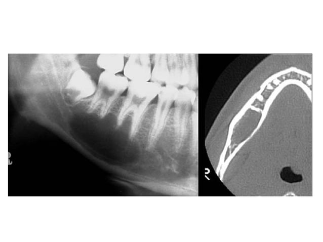 Diagnostic Imaging of Mandible & Maxilla | PPT | Dental Health ...