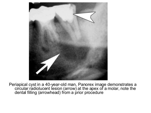 Diagnostic Imaging of Mandible & Maxilla