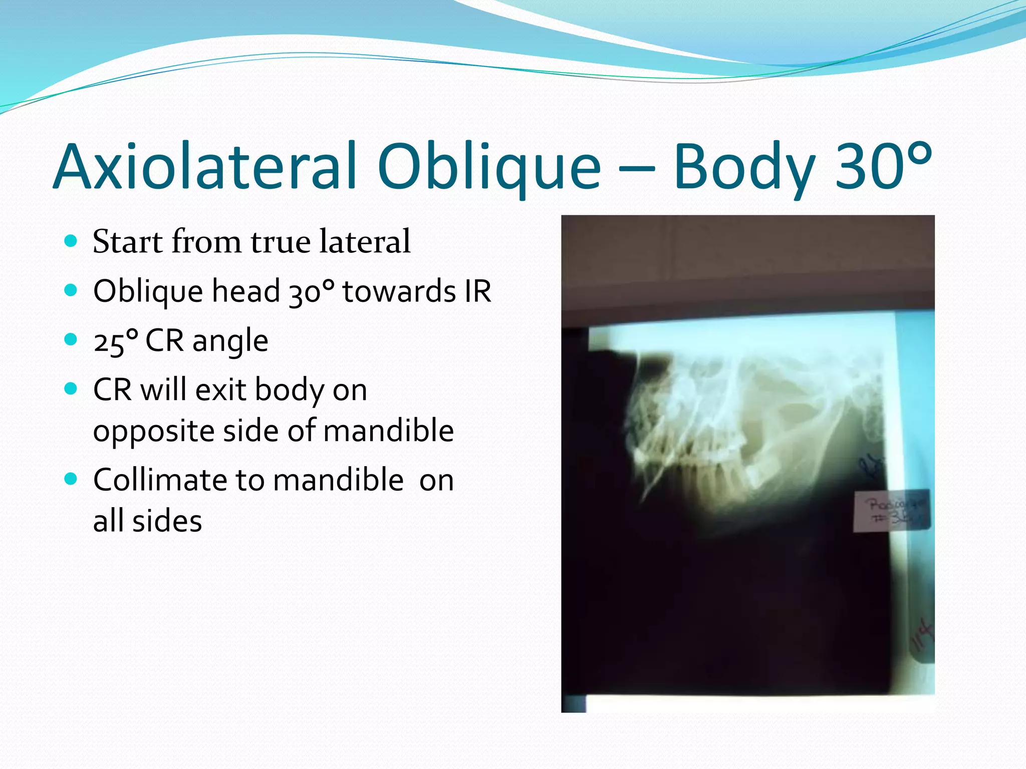 Mandible and maxilla oblique radiography | PPTX