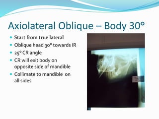 Mandible and maxilla oblique radiography | PPTX