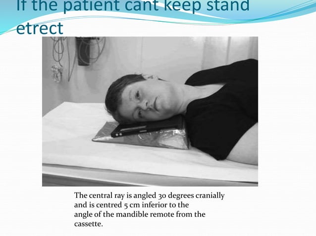 Mandible and maxilla oblique radiography | PPTX | Dental Health ...
