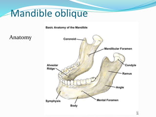 Mandible and maxilla oblique radiography | PPTX