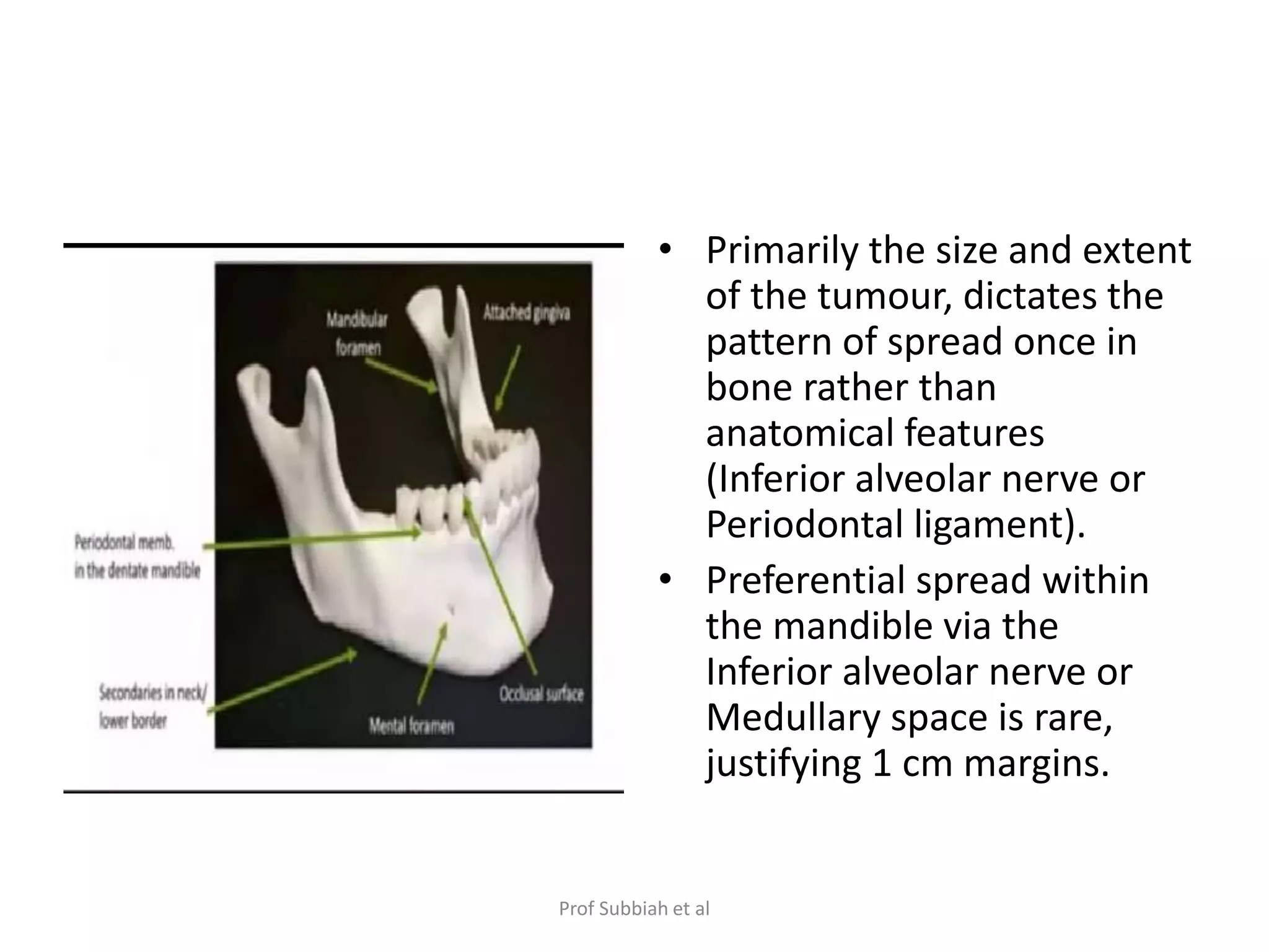 MANAGING MANDIBLE IN ORAL CAVITY CANCERS ppt(1).pptx