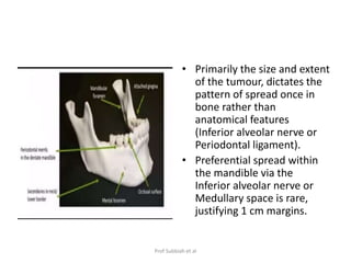 MANAGING MANDIBLE IN ORAL CAVITY CANCERS ppt(1).pptx