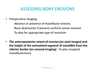 MANAGING MANDIBLE IN ORAL CAVITY CANCERS ppt(1).pptx