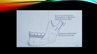 Growth and Development of Mandible | PPTX