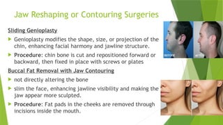 MANDIBLE REHABILITATION AND COSMETIC SURGERY.pptx