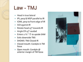 Mandible, T M J | PPTX