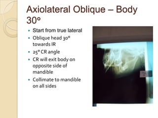 Mandible, T M J | PPTX
