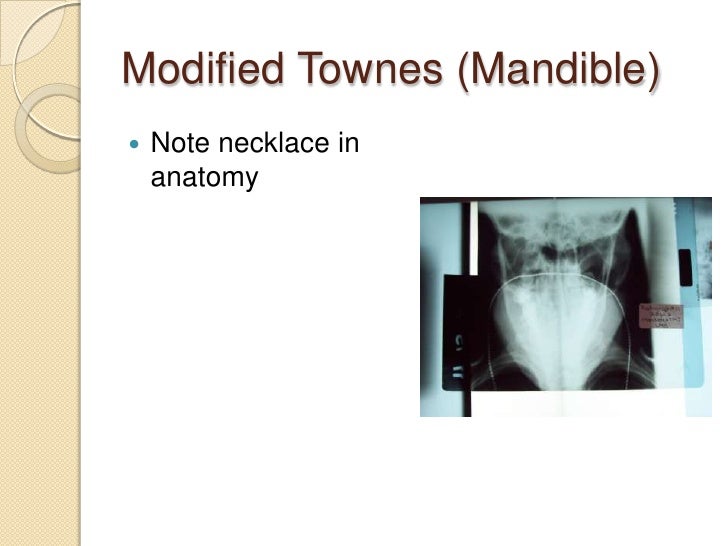Mandible, T M J