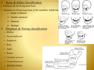Mandibular fractures | PPTX
