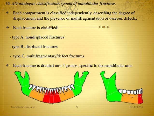 Mandible Fracture Classification