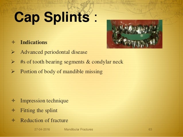 Mandibular fractures