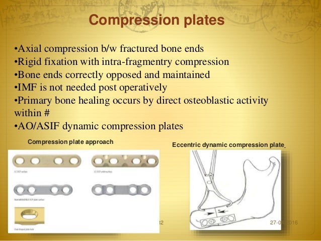 Mandibular fractures