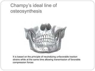 Mandibular-#-2.pptx