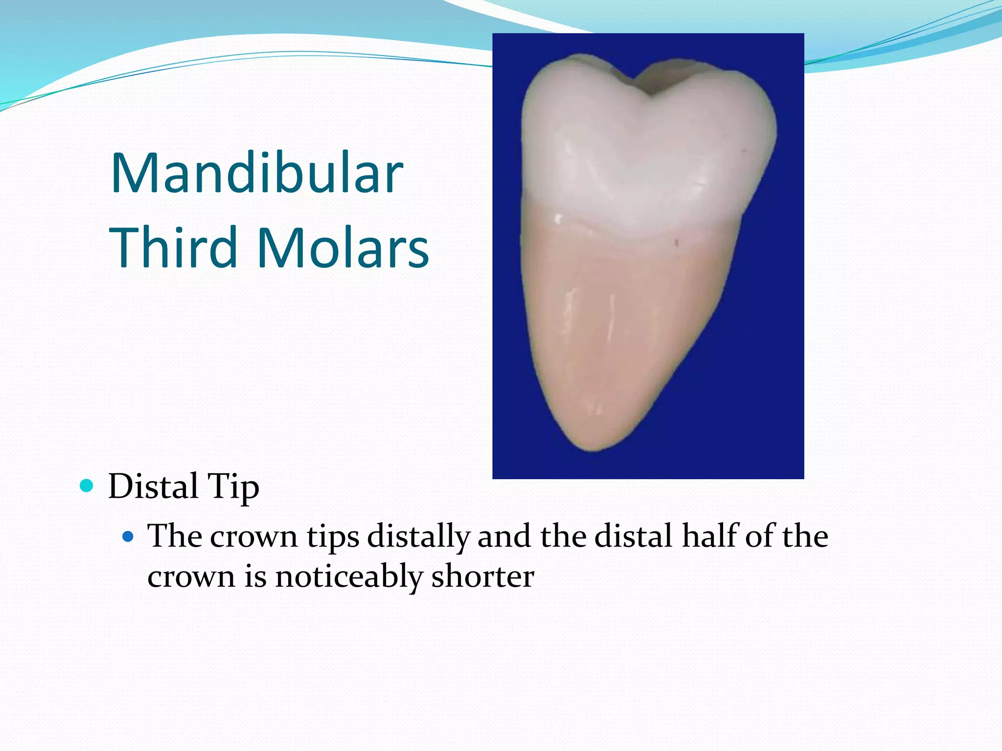 Mandibular 2nd Molars.pptx