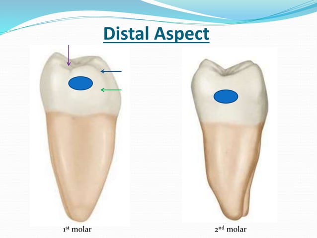 Mandibular 2nd Molars.pptx