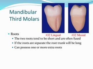 Mandibular 2nd Molars.pptx