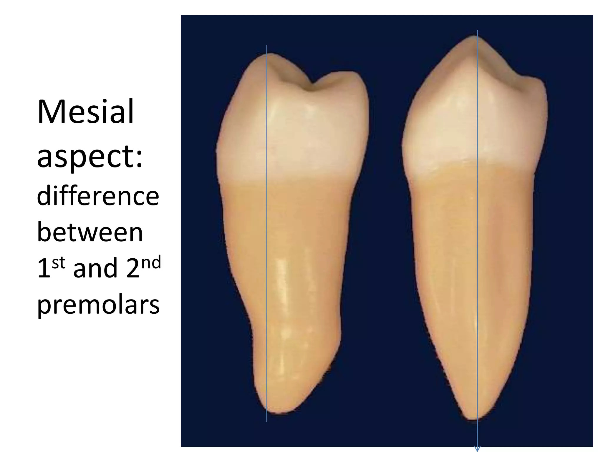 Mandibular 2nd premolar | PPTX