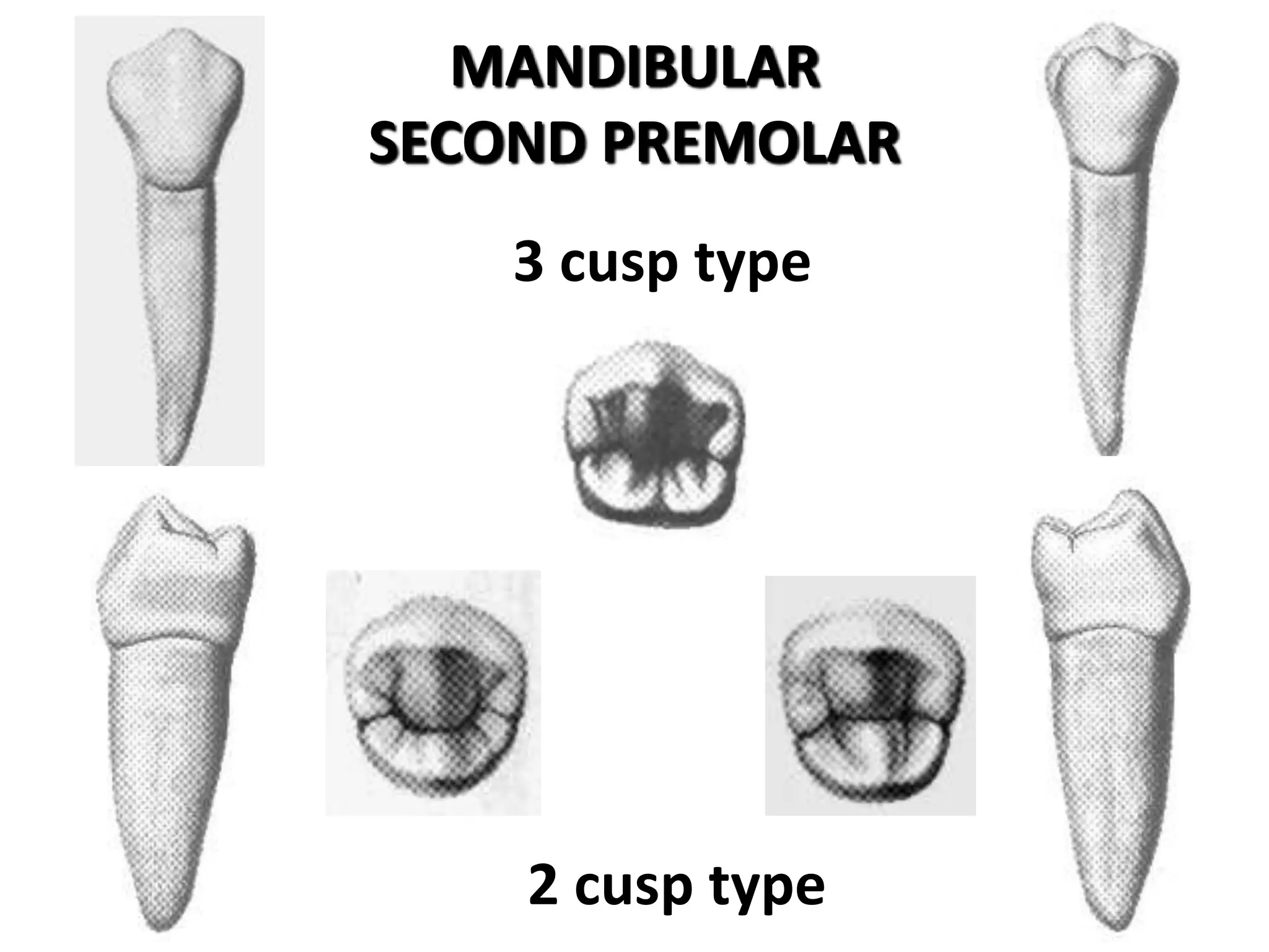 Mandibular 2nd premolar | PPTX