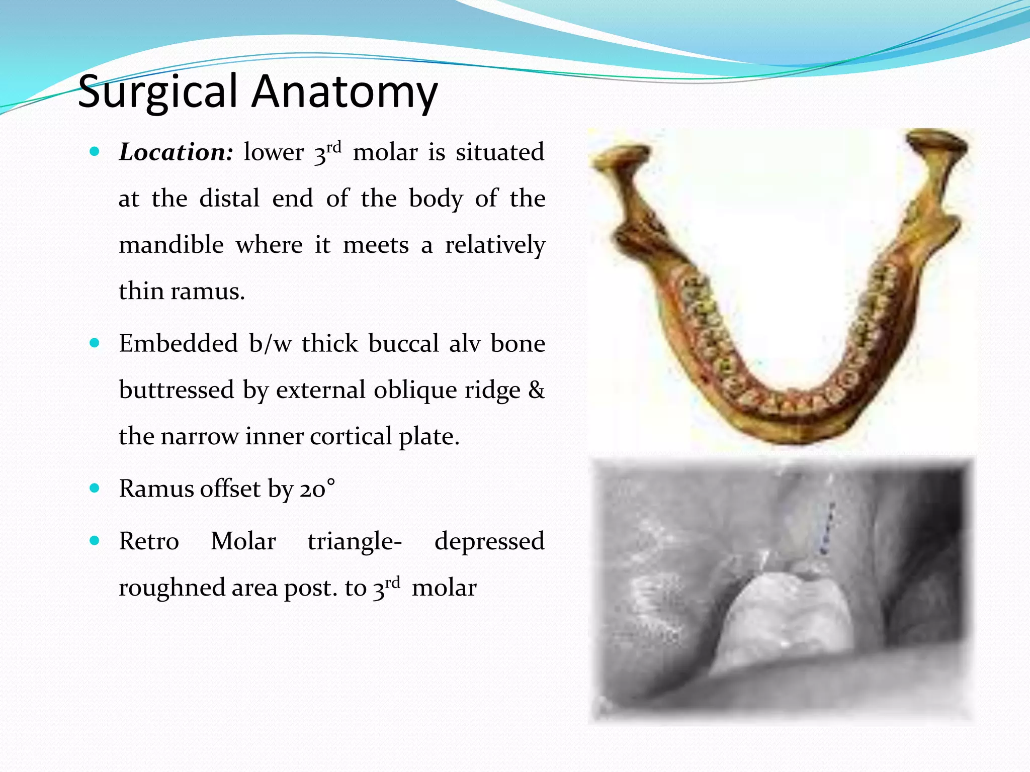 Mandibular 3rd molar impactions | PPTX