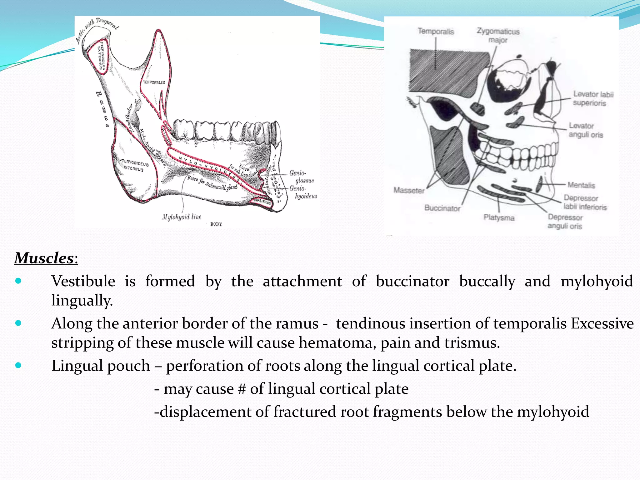 Mandibular 3rd molar impactions | PPTX