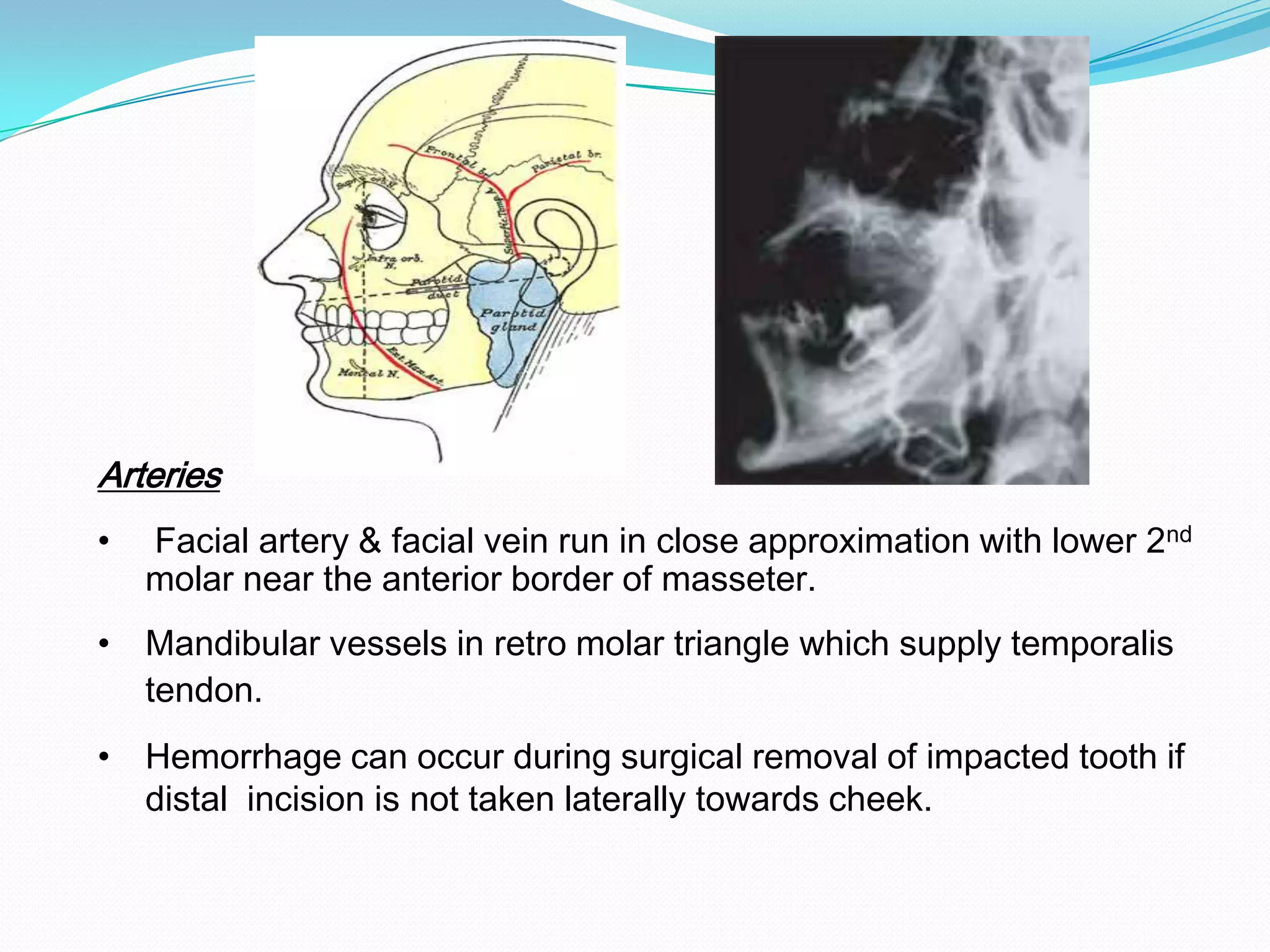 Mandibular 3rd molar impactions | PPTX
