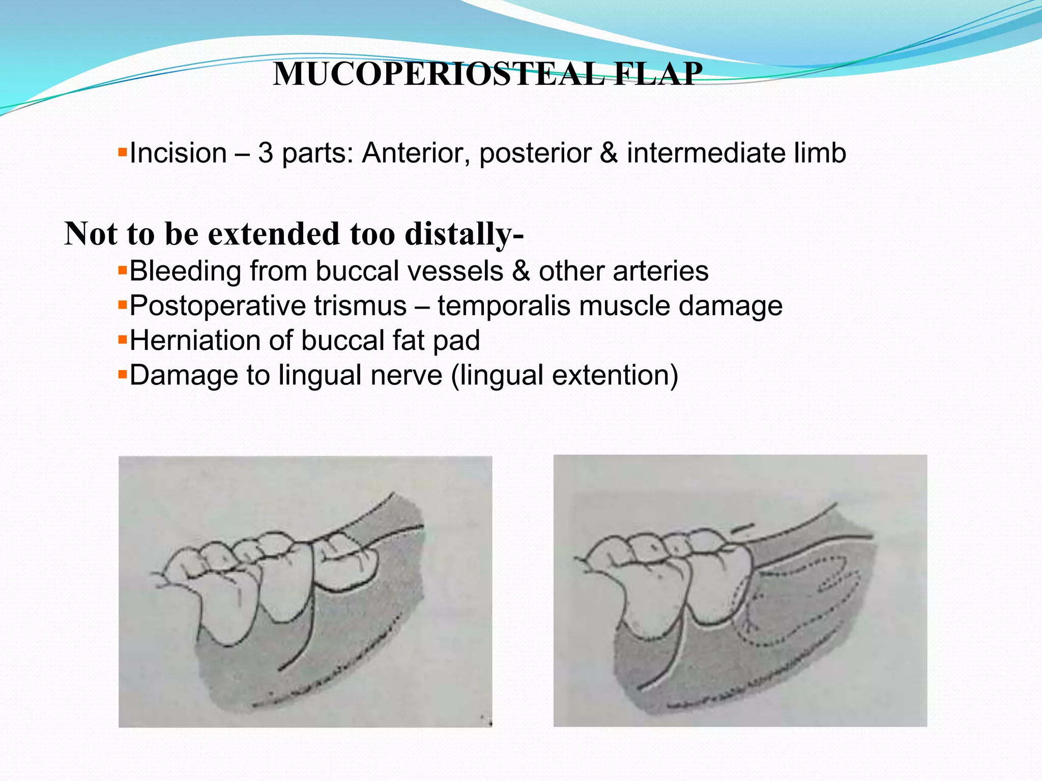 Mandibular 3rd molar impactions | PPTX