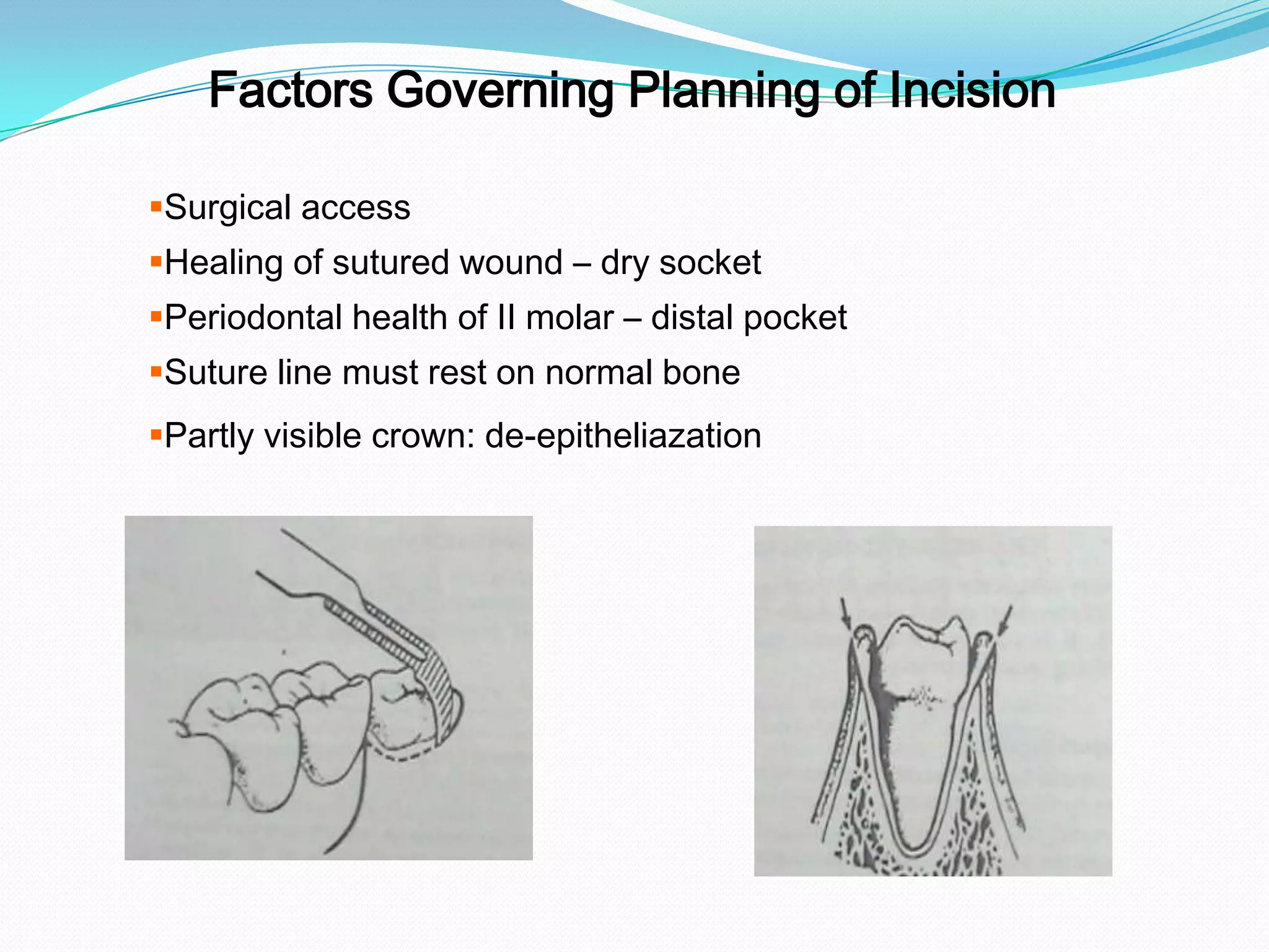 Mandibular 3rd molar impactions | PPTX