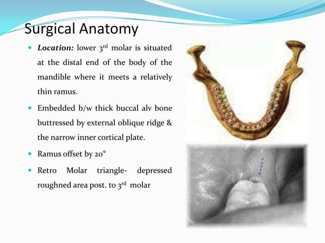 Mandibular 3rd molar impactions | PPTX | Ear, Nose and Throat ...