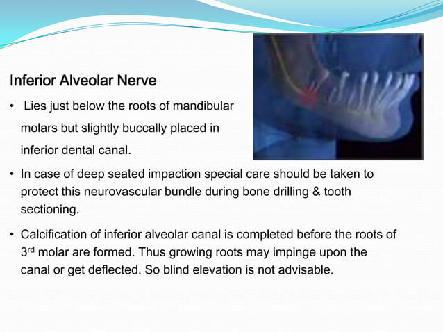 Mandibular 3rd molar impactions | PPTX | Ear, Nose and Throat ...