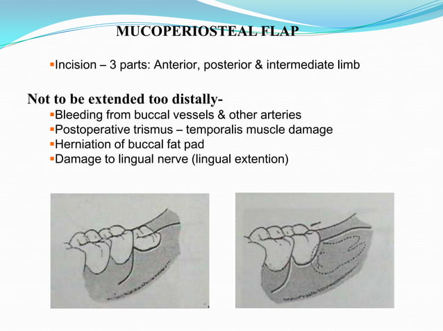 Mandibular 3rd molar impactions | PPTX | Ear, Nose and Throat ...